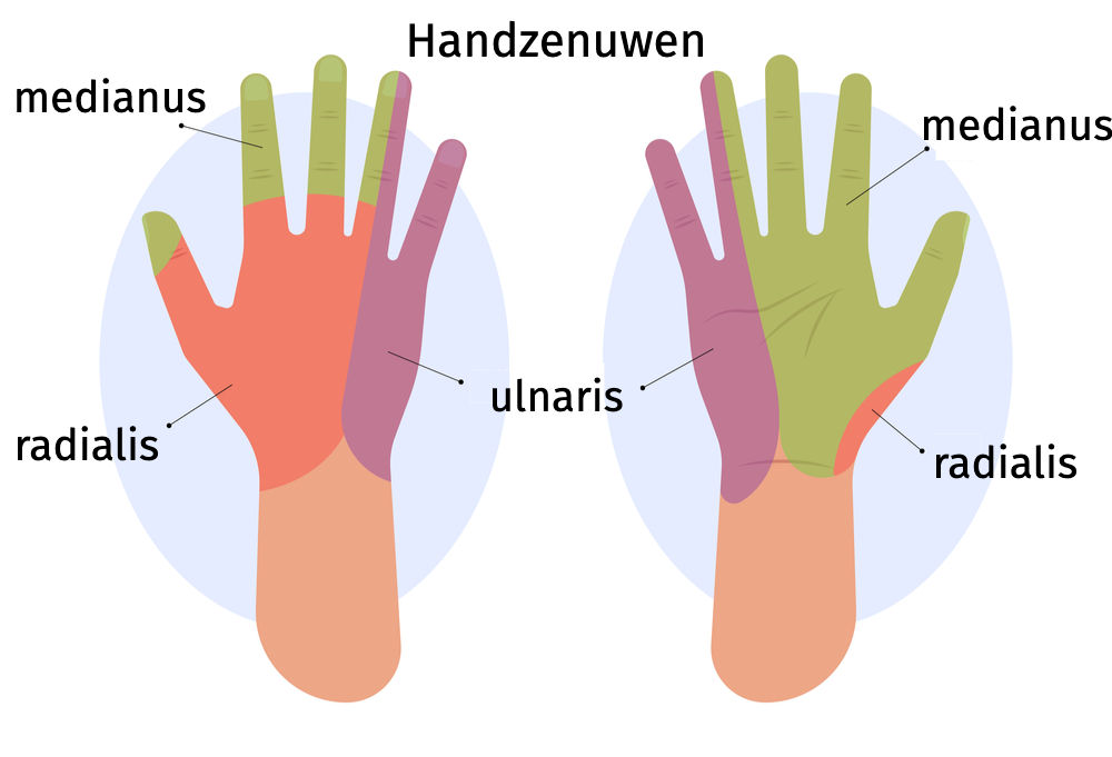 Radialis neuropathie